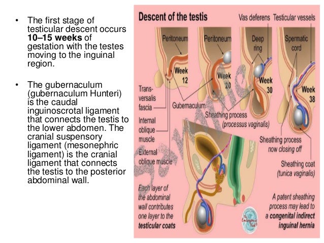 Development Of Testis And Cryptorchidism Presentation