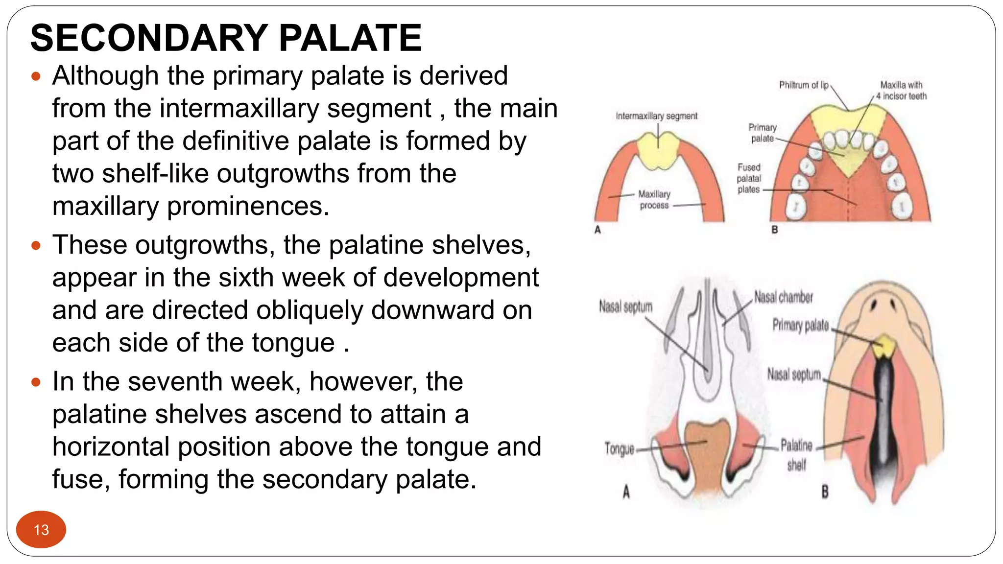 development of the face and palate.pptx