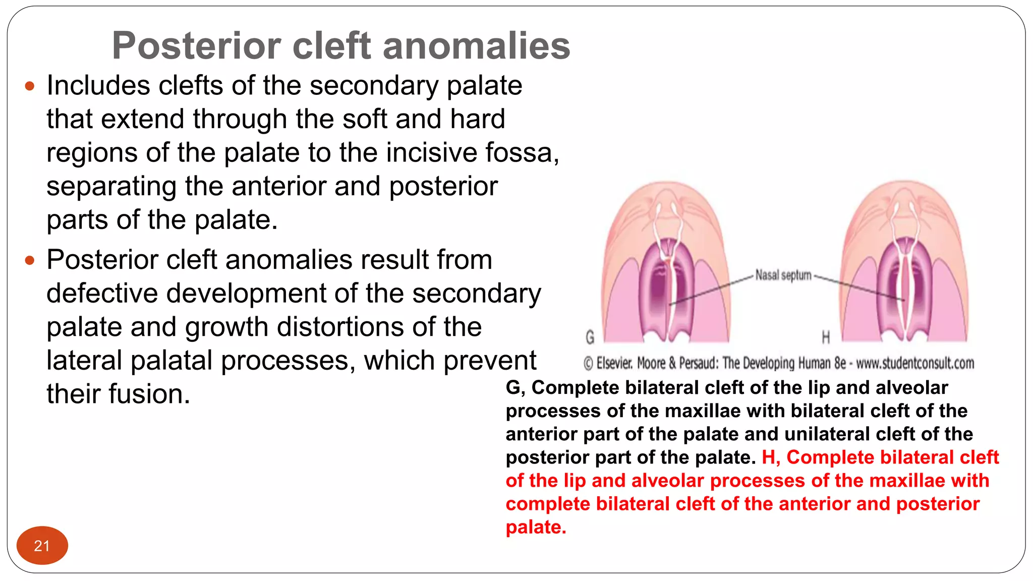 development of the face and palate.pptx