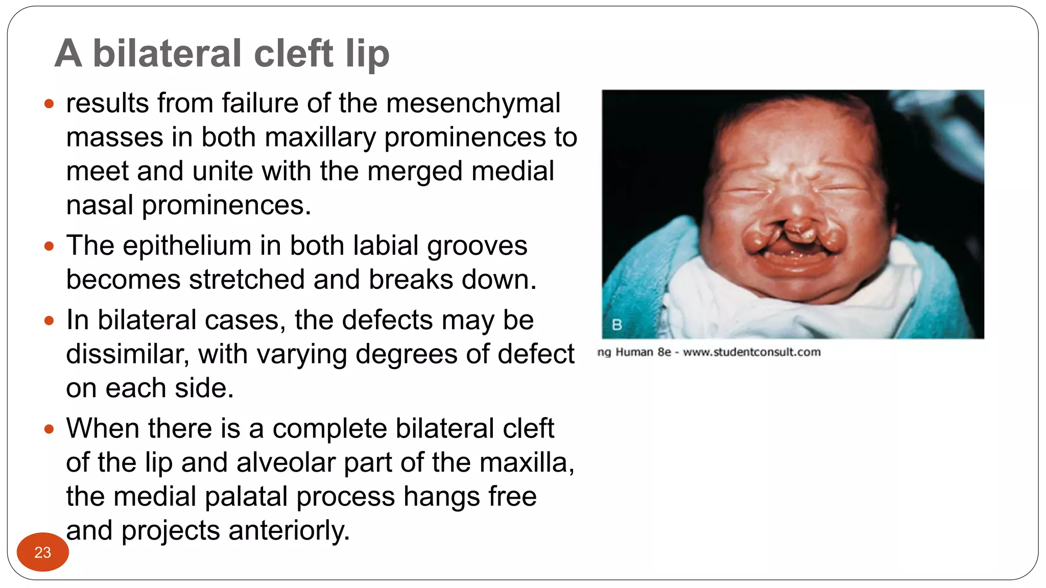 development of the face and palate.pptx