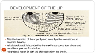 development of the face and palate.pptx