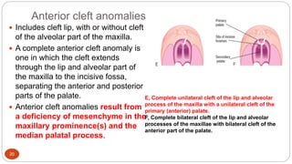 development of the face and palate.pptx