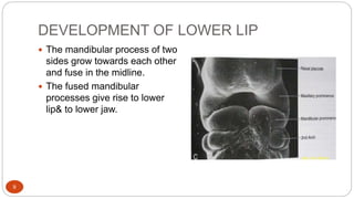 development of the face and palate.pptx