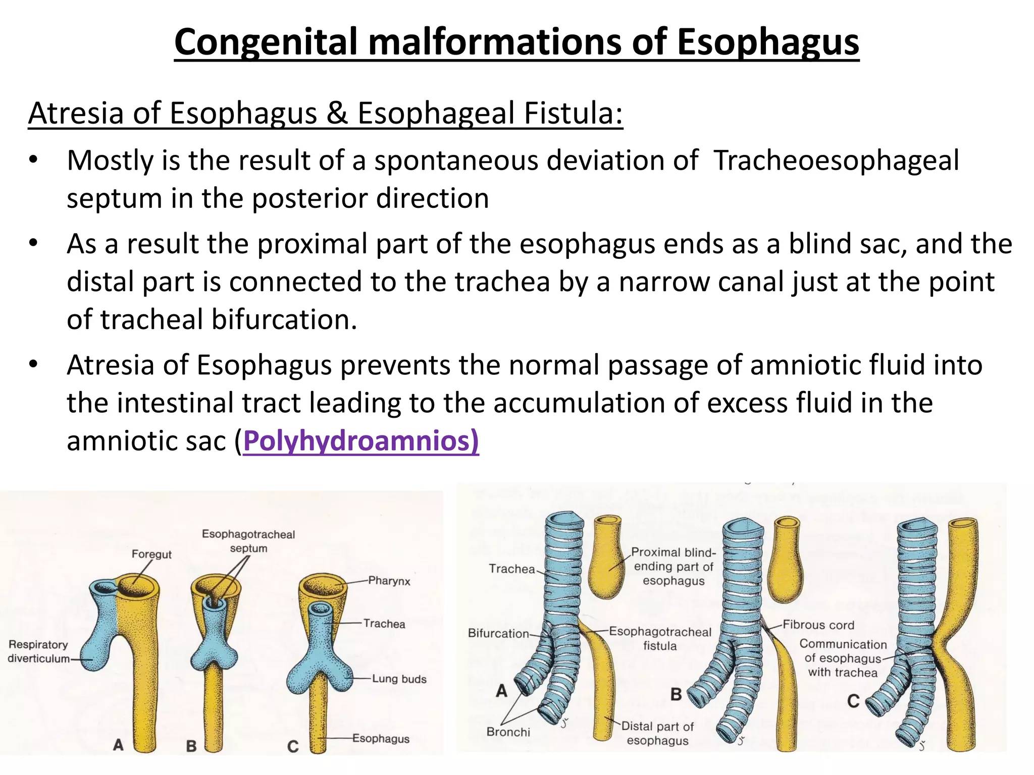 Development of the foregut (esophagus and stomach | PDF
