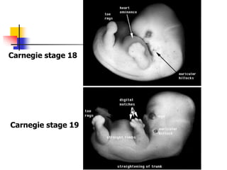 Development of the general body form.ppt