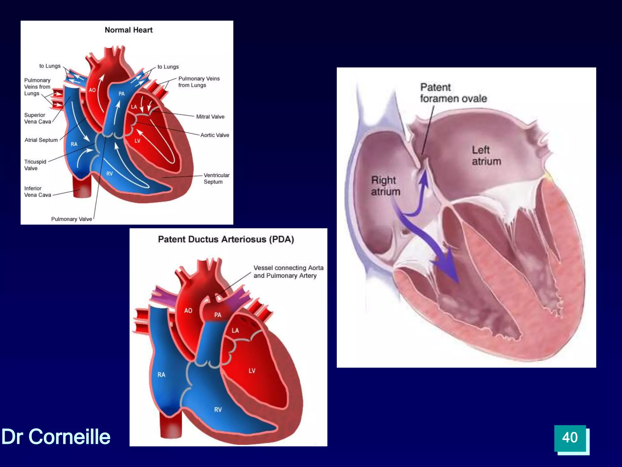 Development of the Great Vessels & Fetal Circulation.pptx