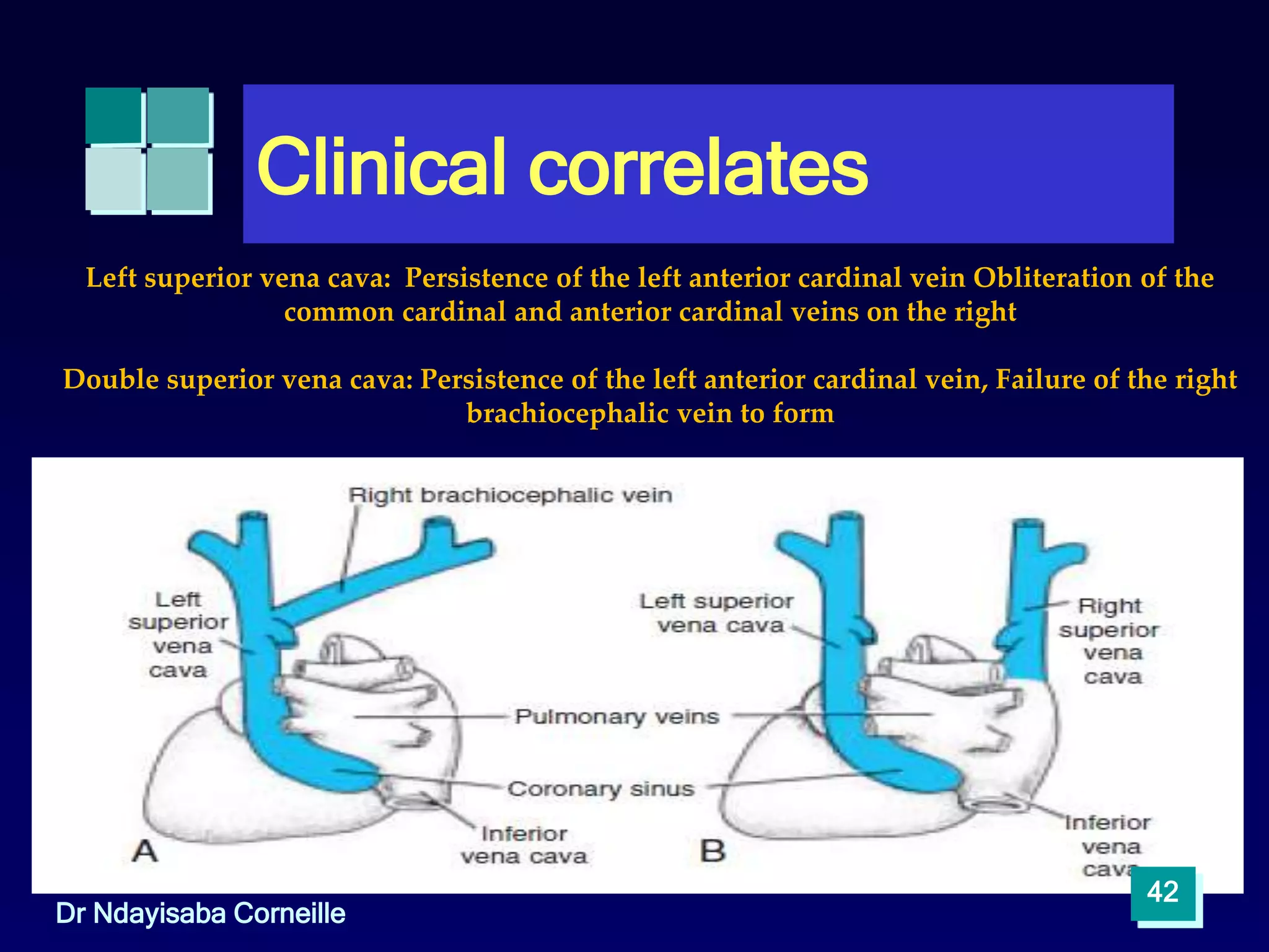 Development of the Great Vessels & Fetal Circulation.pptx