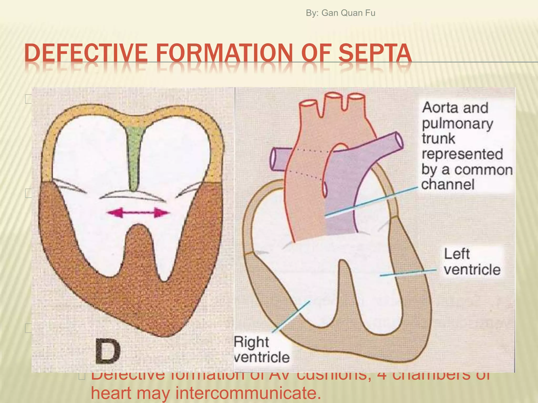 Development of the heart | PPTX