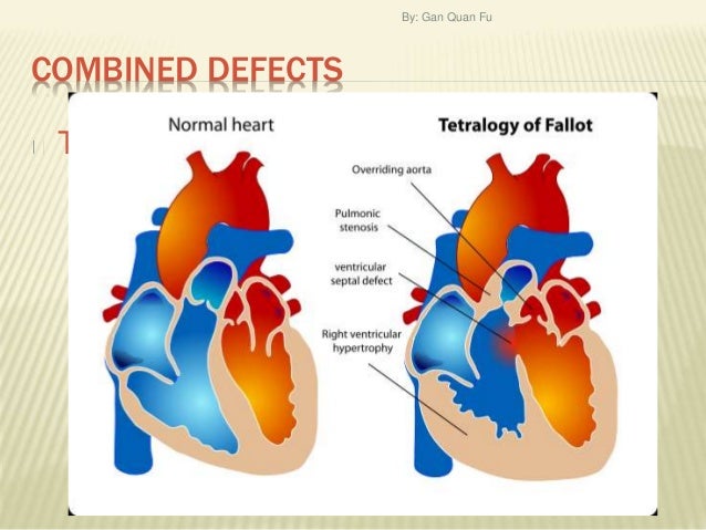 Development of the heart