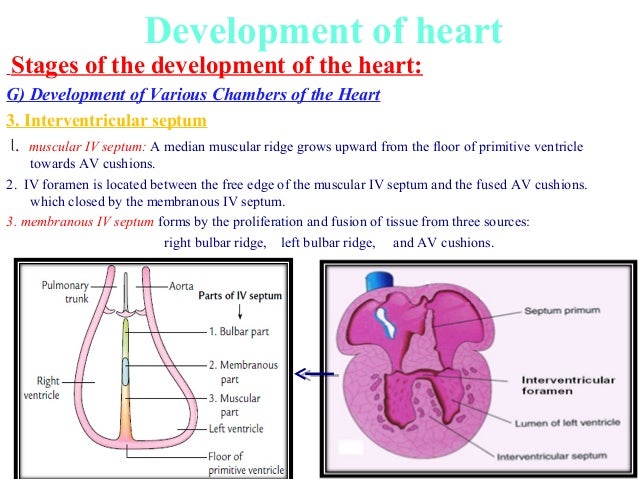Interventricular Septum Development Membranous Part Of