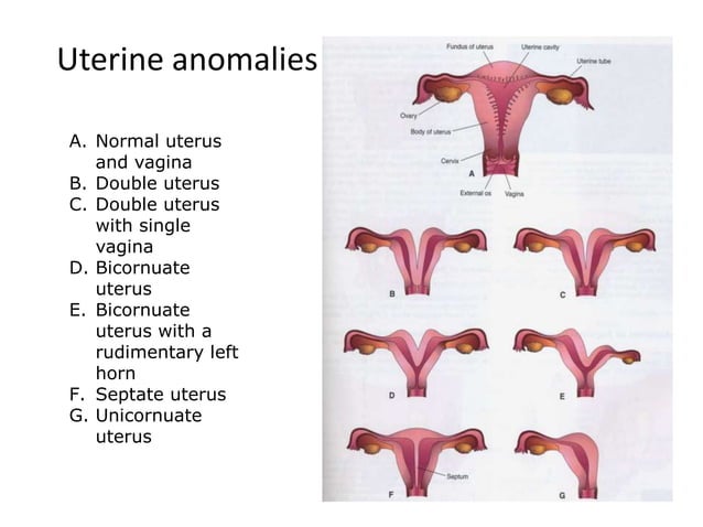 Development of the male and female genital tracts | PPTX