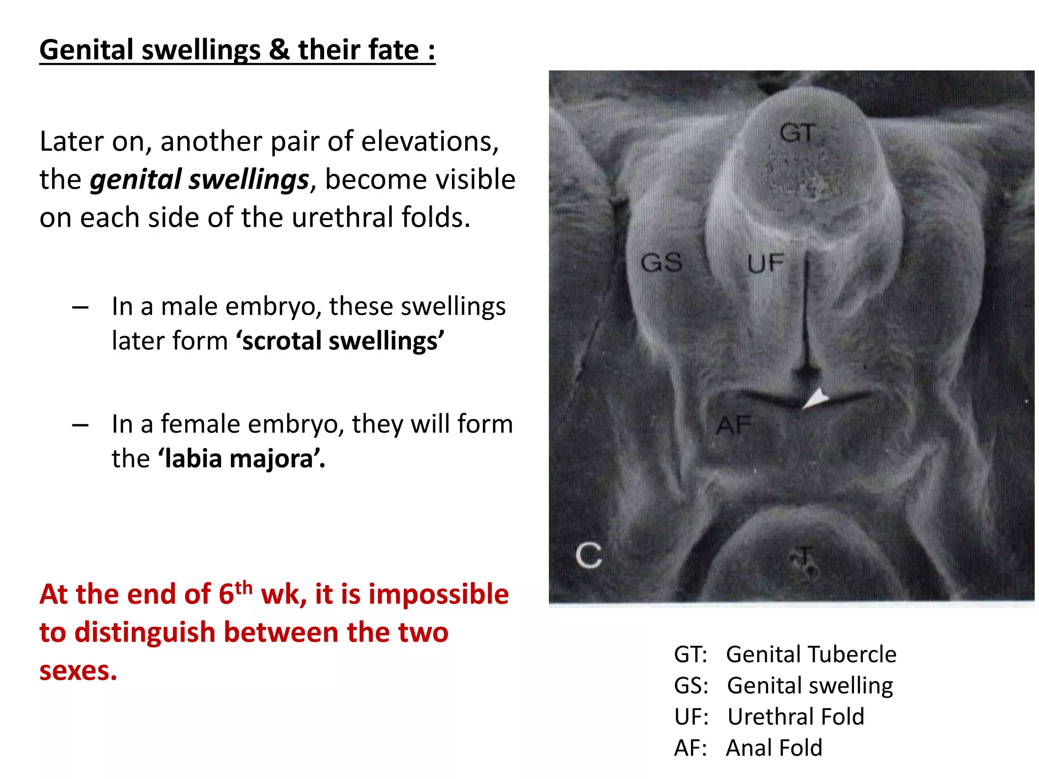 Development of the male reproductive system | PPTX