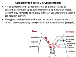 Development of the male reproductive system | PPTX