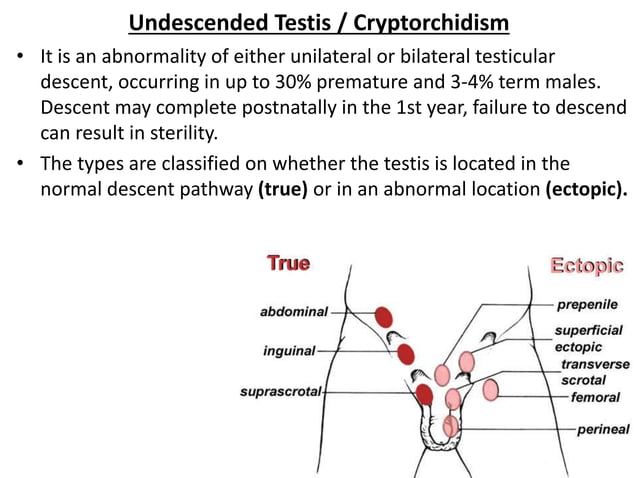 Development of the male reproductive system | PPTX