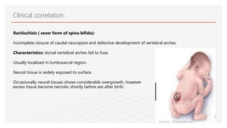 Development of the nervous system | PPTX