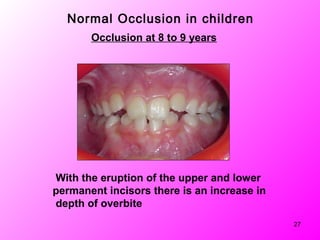 Development of the teeth and occlusion | PPT