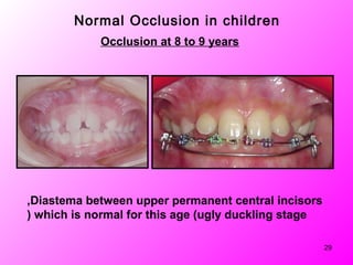 Development of the teeth and occlusion | PPT