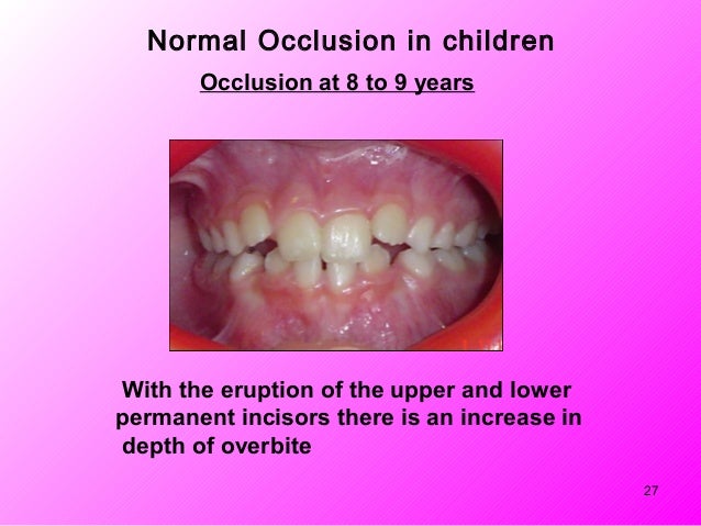 Development of the teeth and occlusion