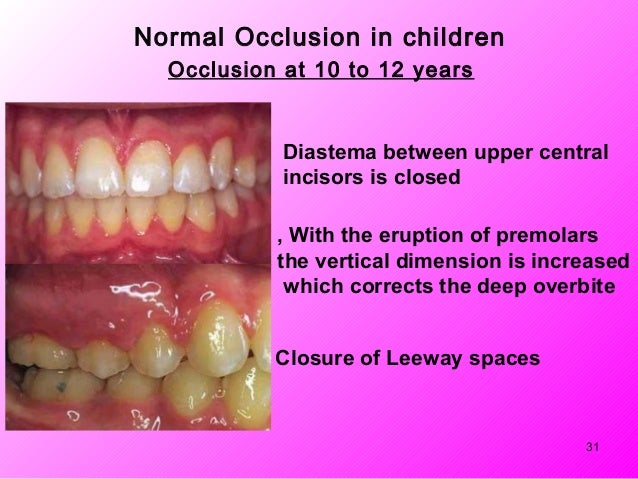 Development of the teeth and occlusion