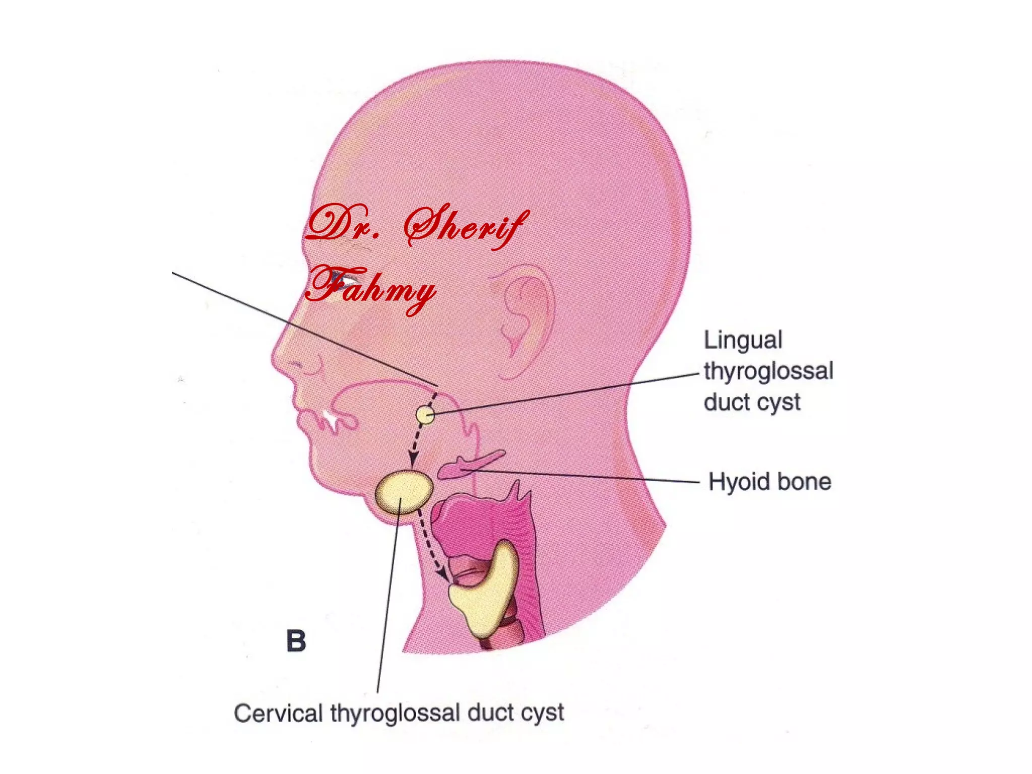 Development of Thyroid Gland (Special Embryology) | PPS
