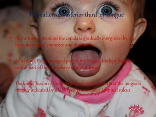 Development of tongue | PPTX