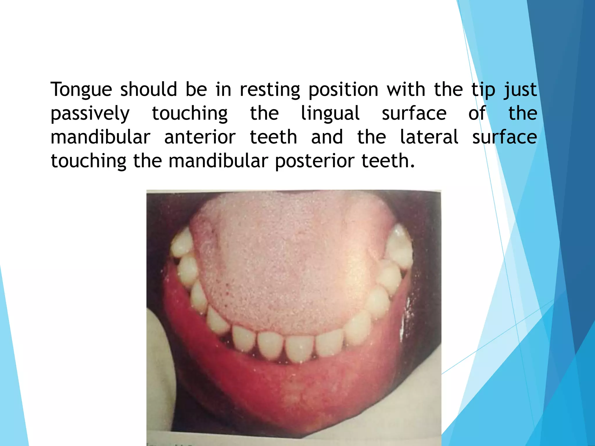 Development of tongue, Speech & Prosthodontic consideration | PPTX