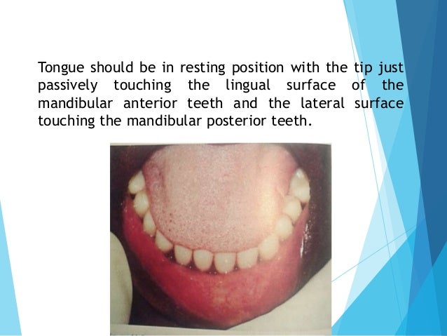 Development of tongue, Speech & Prosthodontic consideration