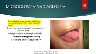 Development of tongue and its applied anatomy | PPTX