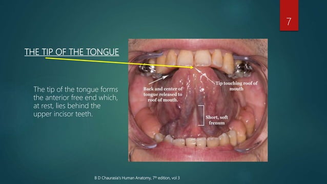 Development of tongue and its applied anatomy | PPTX