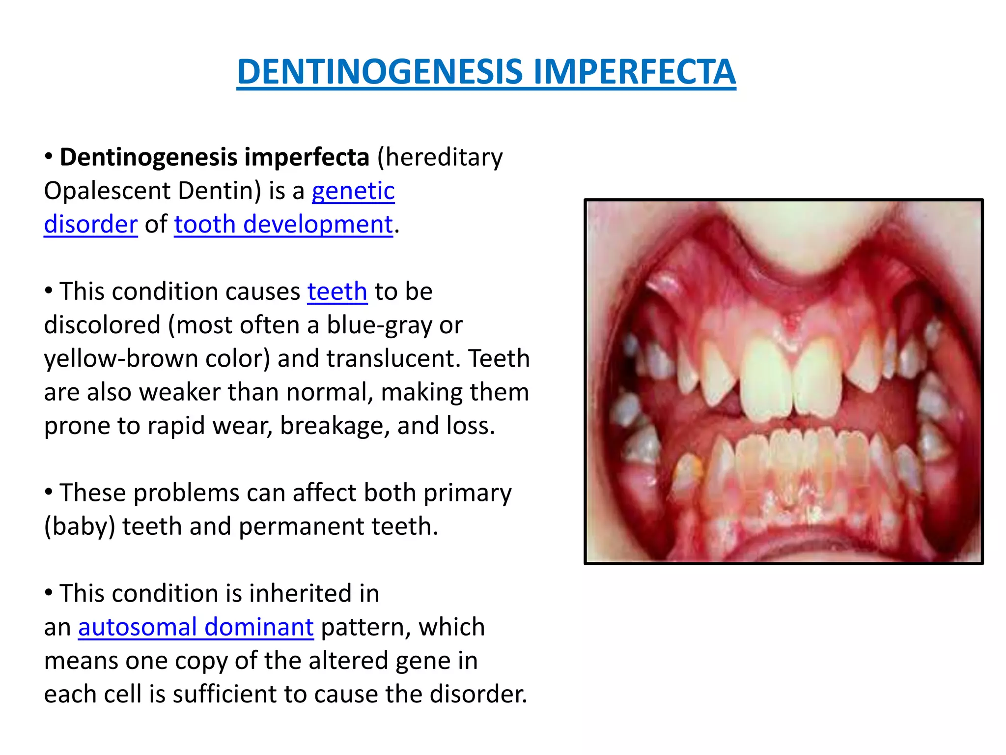 Development of tooth | PPTX