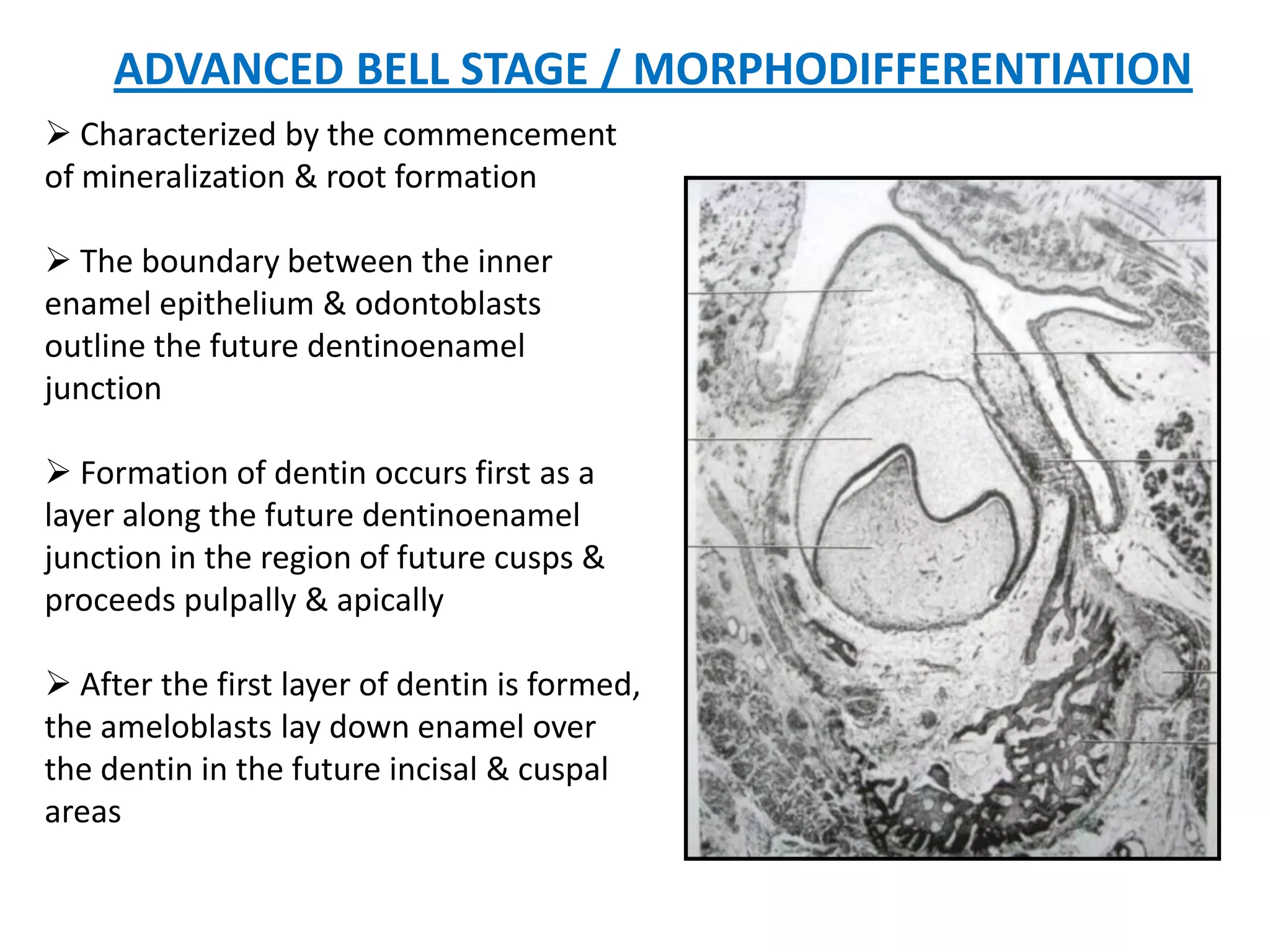 Development of tooth | PPTX