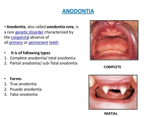 Development of tooth