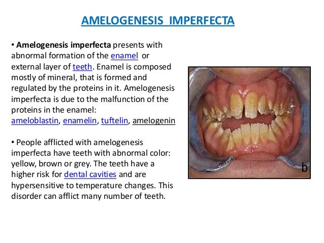Development of tooth