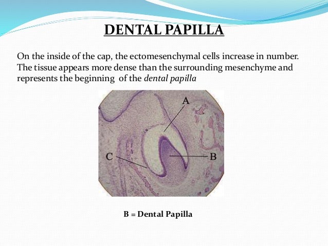 Development of tooth - DCPS