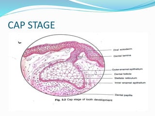 Development of tooth | PPTX