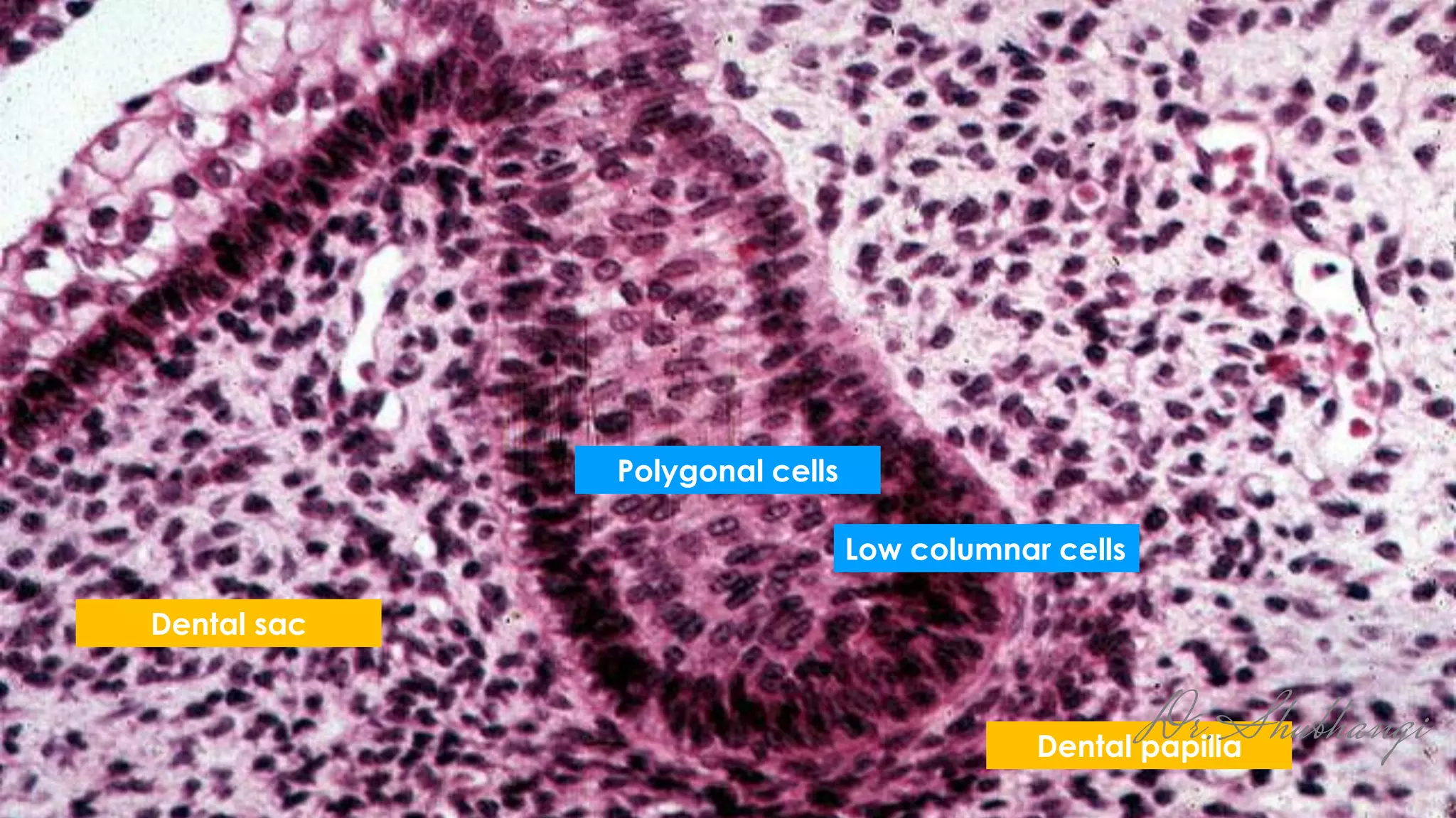 Development of tooth | PDF