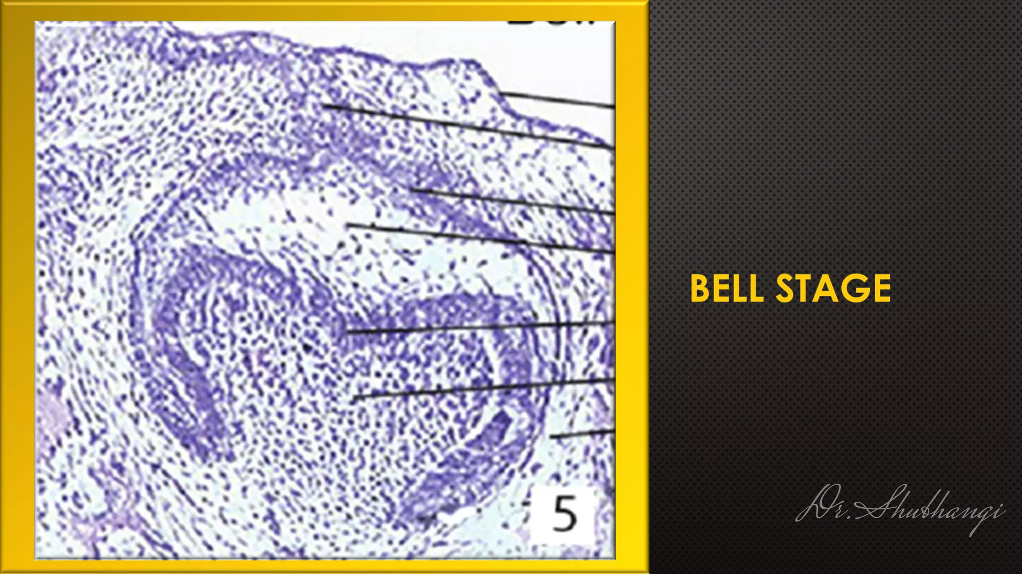 Development of tooth | PDF