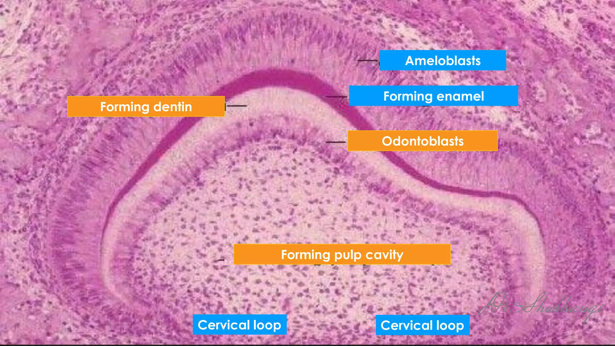 Development of tooth | PDF