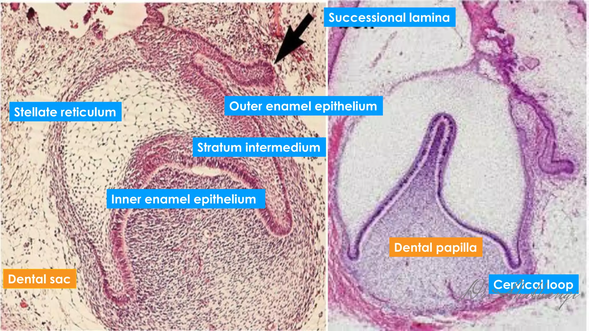 Development of tooth | PDF