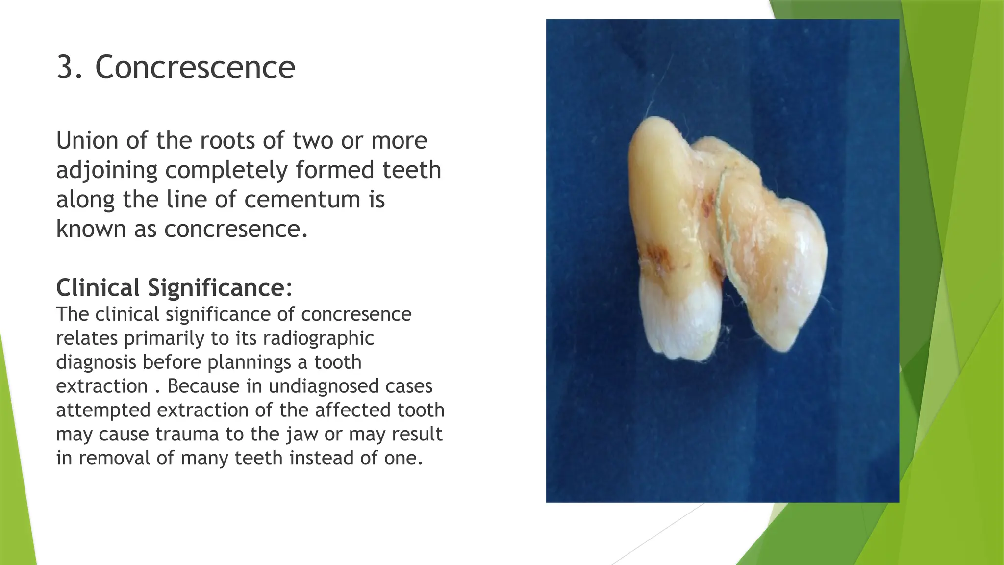 Development of Tooth and developmental anomaly of tooth.pptx