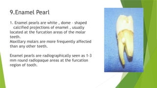Development of Tooth and developmental anomaly of tooth.pptx