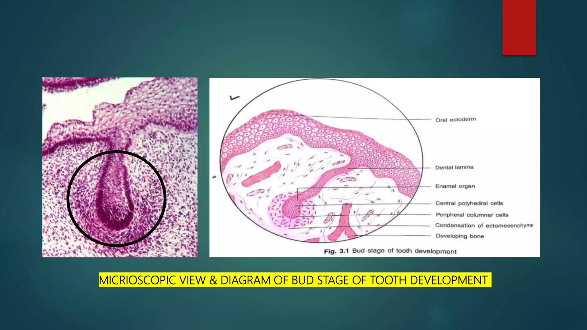 Development of tooth | PPTX