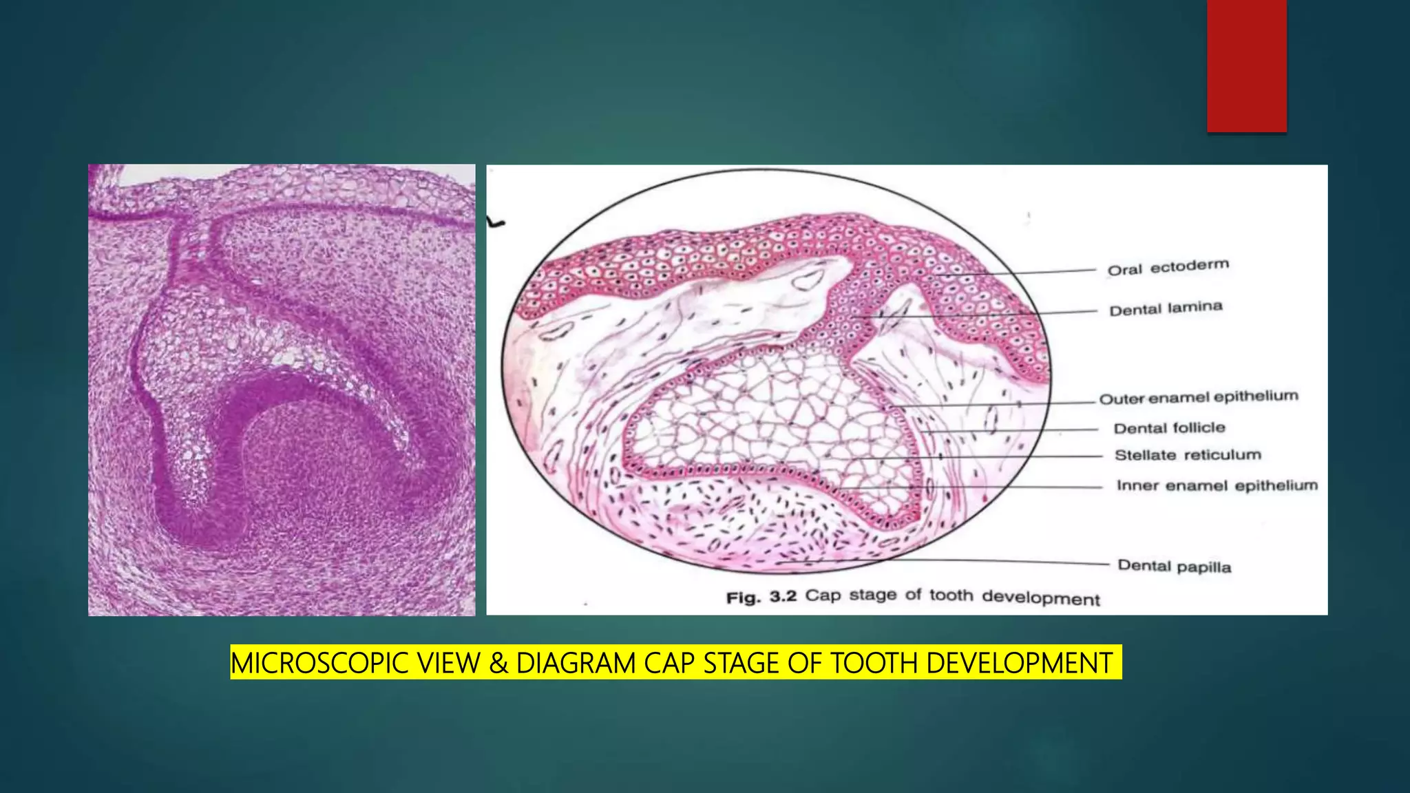 Development of tooth | PPTX