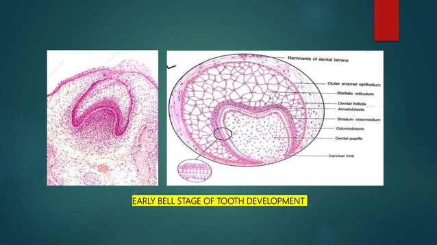 Development of tooth | PPTX | Dental Health | Diseases and Conditions