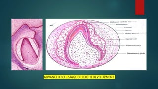 Development of tooth | PPTX