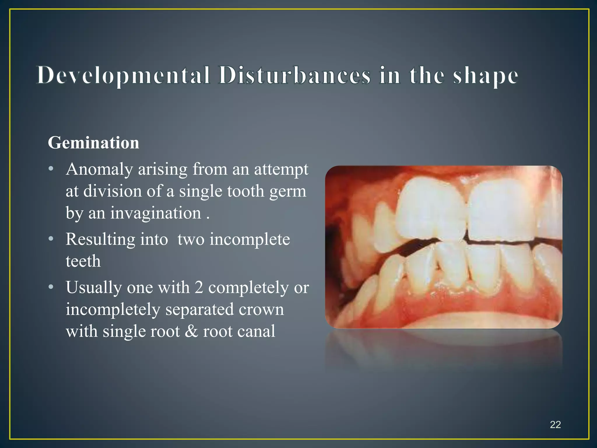 Development of tooth Part 2 | PPTX