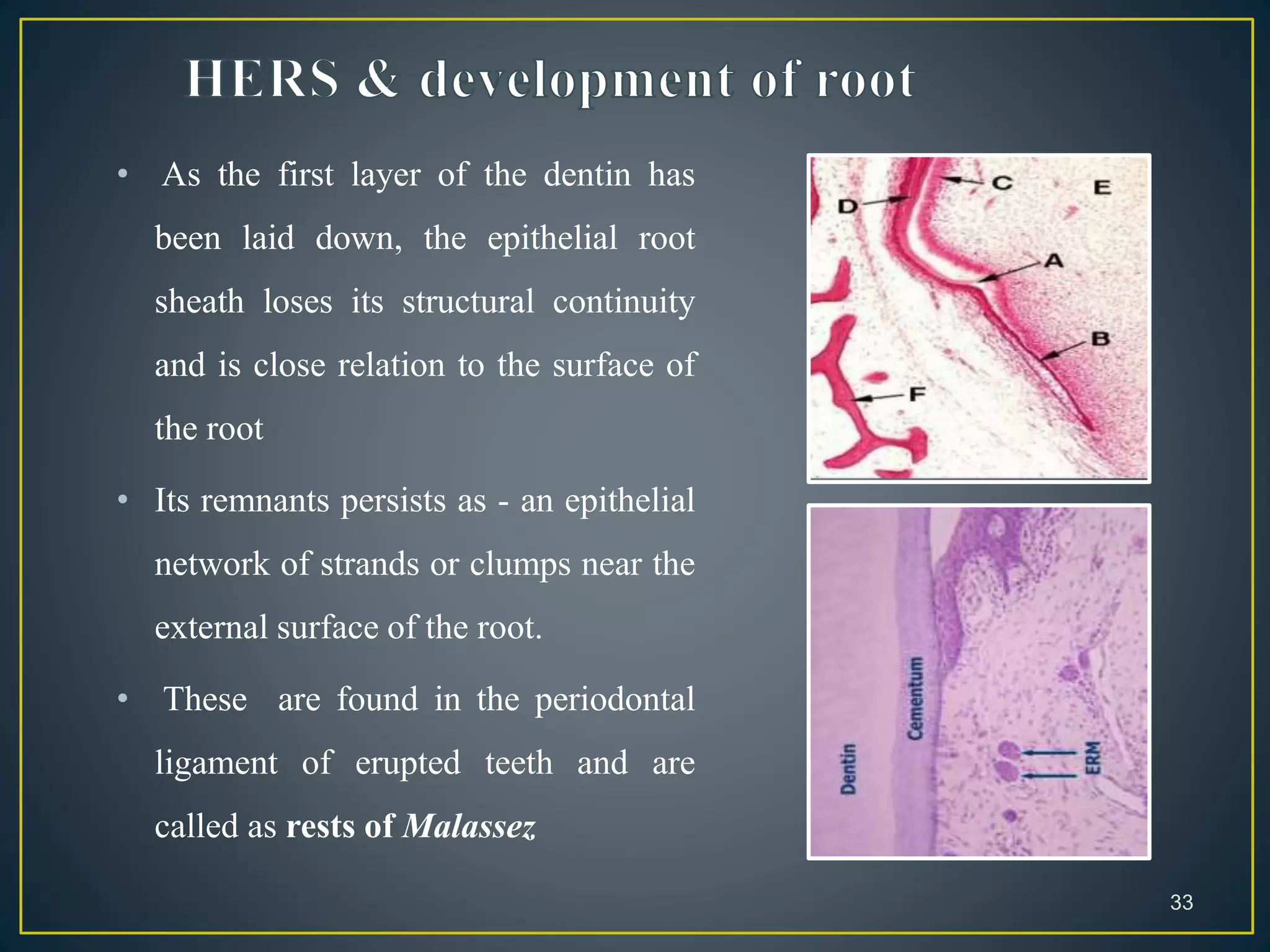 Development of tooth Part 2 | PPTX