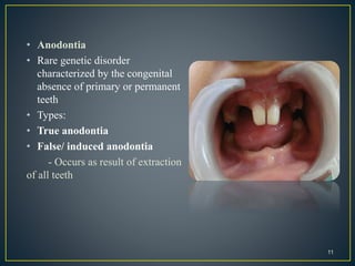 Development of tooth Part 2 | PPTX