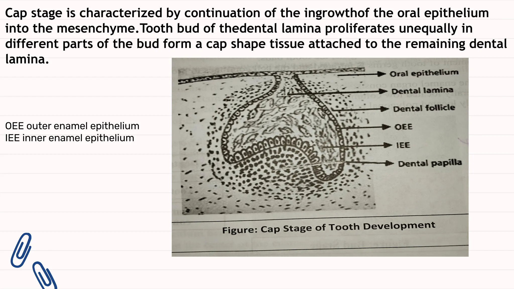 Development of tooth & It's supporting tissue.pdf