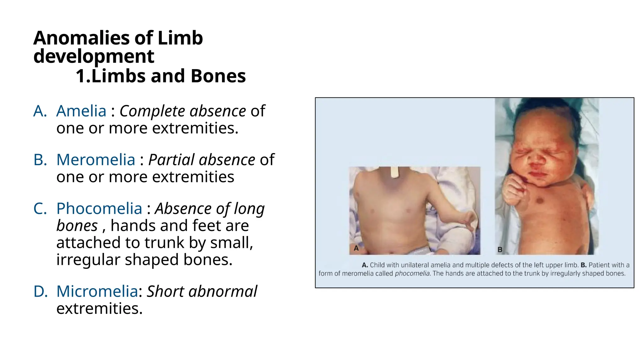 Development of Upper Limb: clear, systematic overview of the ...